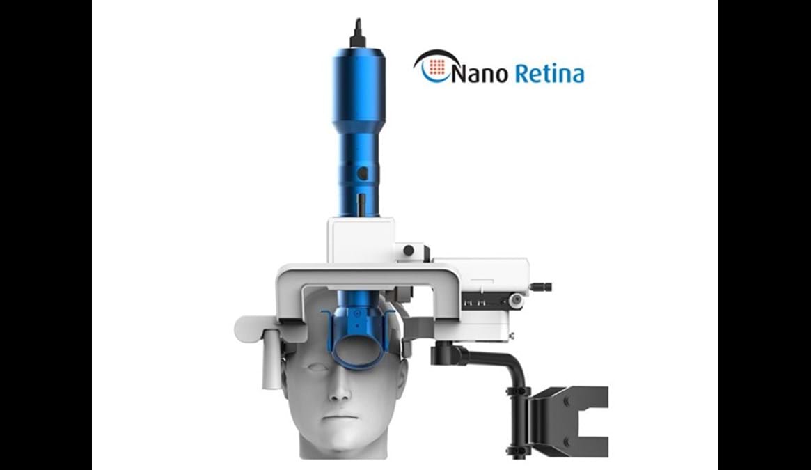 INO | Case Study - Nano Retina